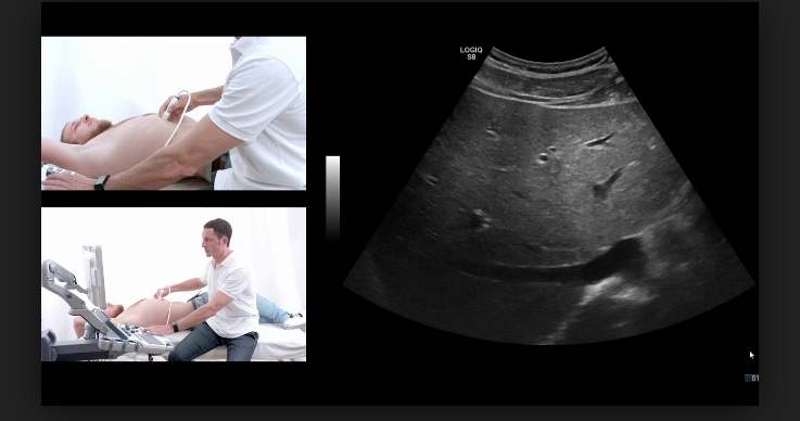 Risiko Dan Manfaat USG